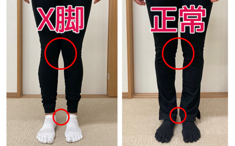 内旋するx脚改善には外旋する梨状筋を鍛えるヨガ運動がおススメ！ 【SUAY-LABO】